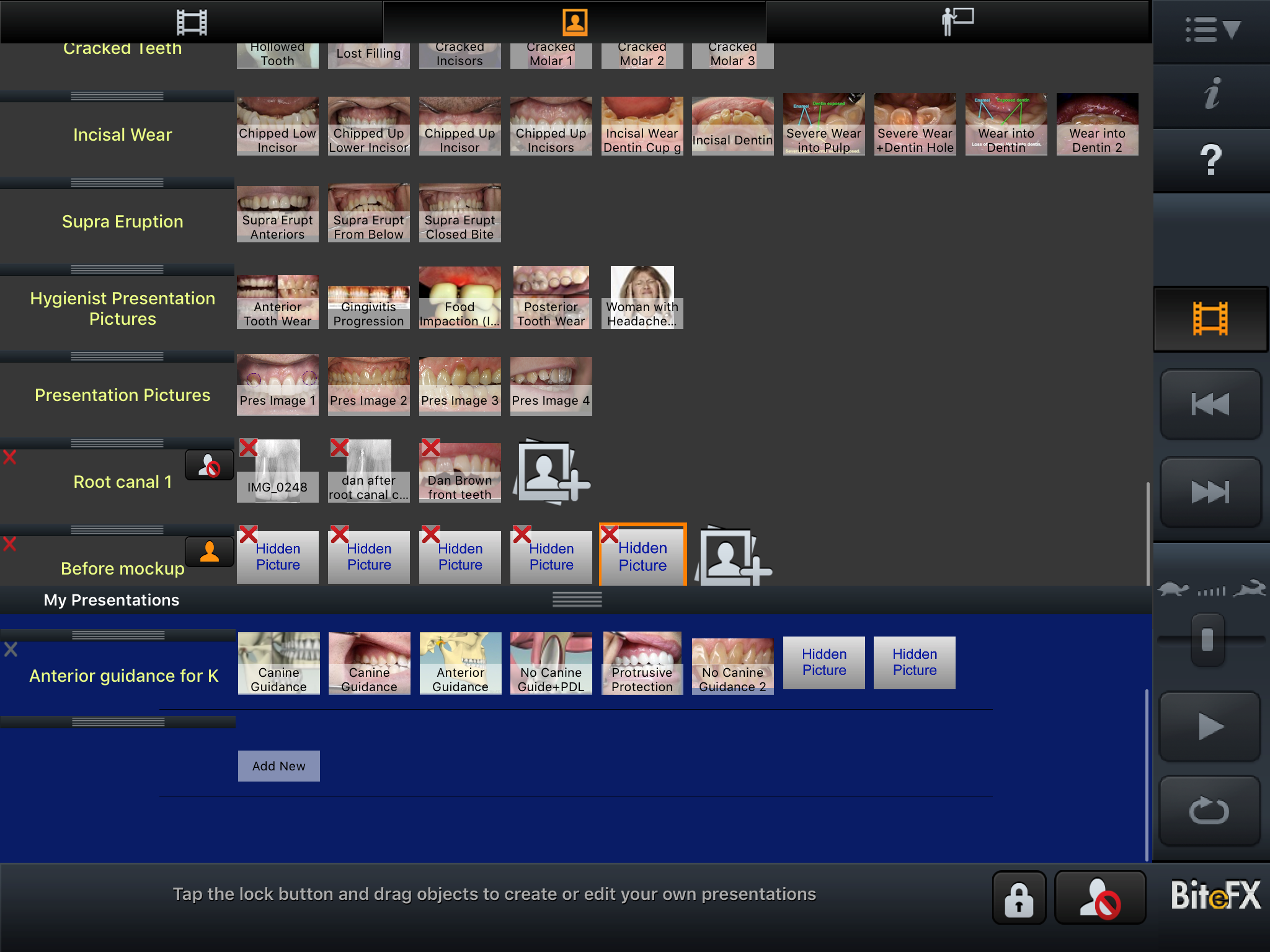 What's New in BiteFX for iPad V3.1